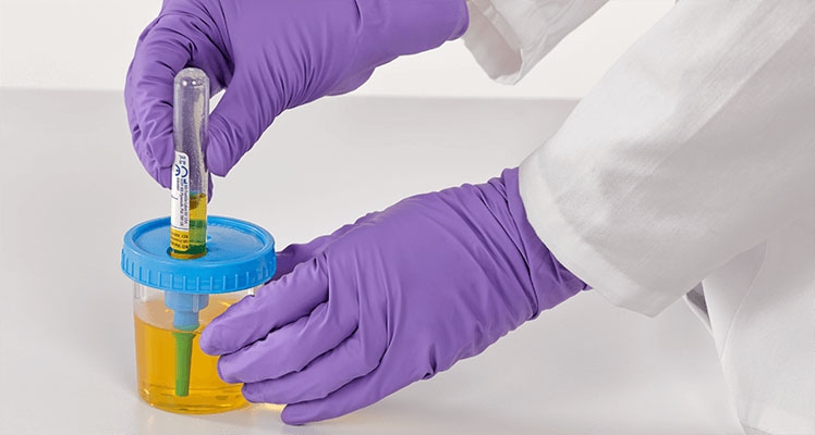 Urine Collection Cup | Mercedes Scientific
