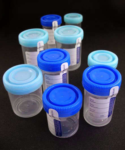 Specimen Container | Mercedes Scientific