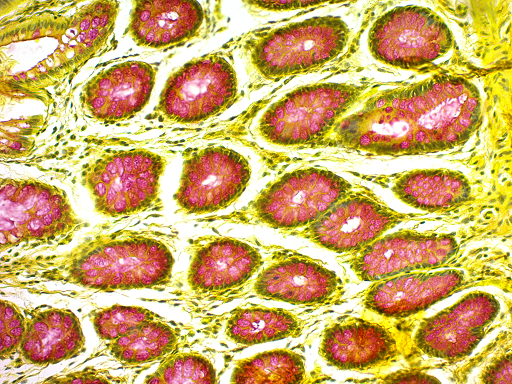Mucicarmine Stain Kit (Modified Southgate's) | Mercedes Scientific