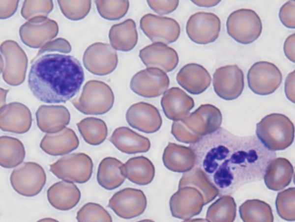 Hematology Stain Set | Mercedes Scientific